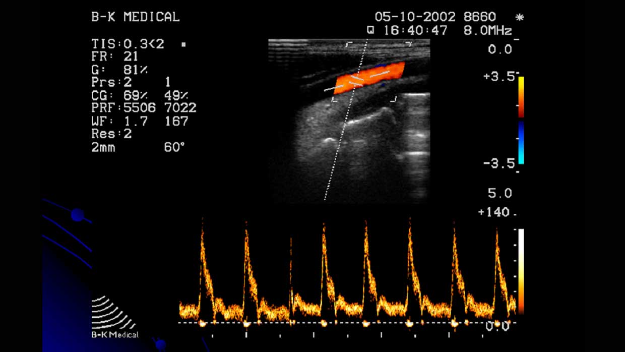 Siêu âm Doppler nguyên lý và kỹ thuật, Bs Dương | Hình ảnh Y khoa ...