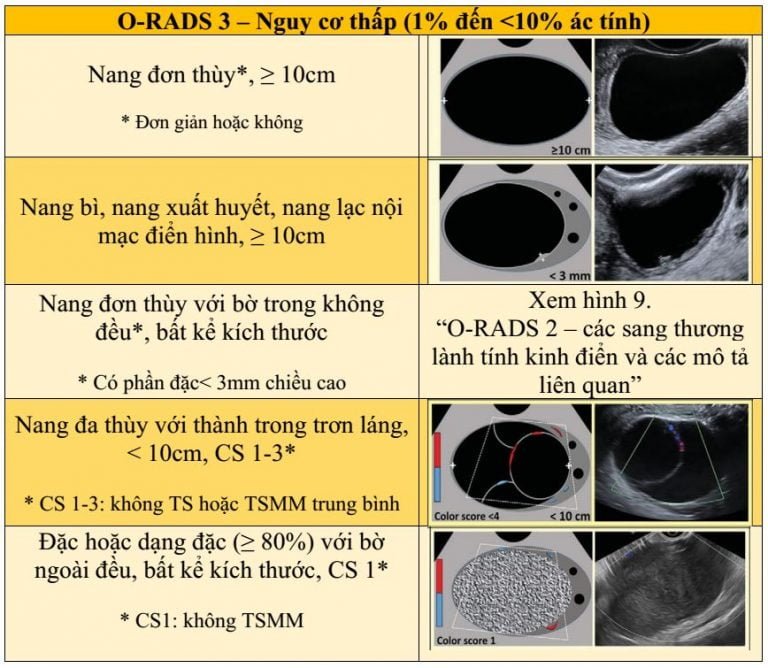 ORADS US Hệ thống phân loại và xử trí các khối u buồng trứng dựa trên ...