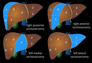 Giải phẫu phân thùy gan (Liver - Segmental Anatomy) | Hình ảnh Y khoa ...